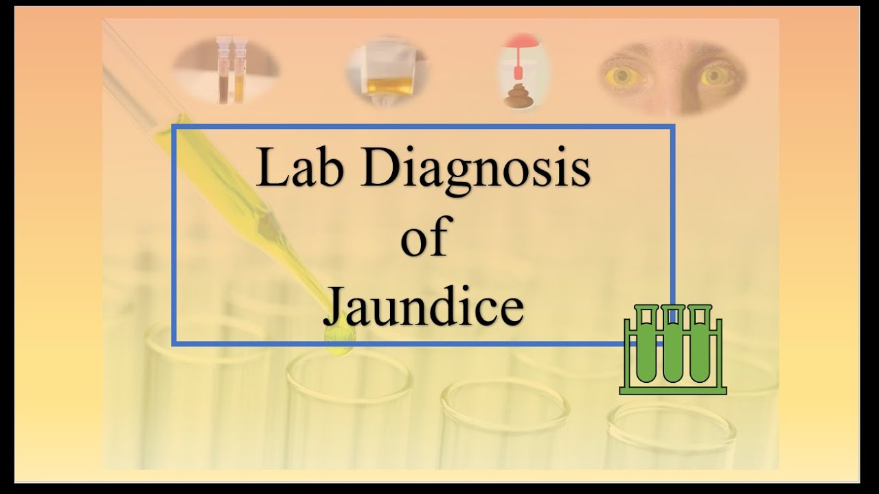 Lab Diagnosis of Jaundice - YouTube