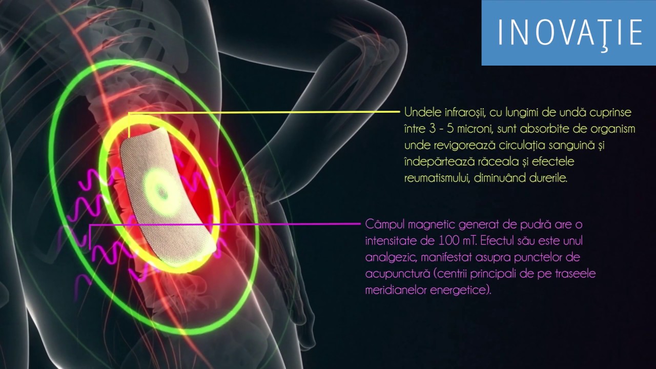 Inovatia plasturilor RheumastoPlast - YouTube