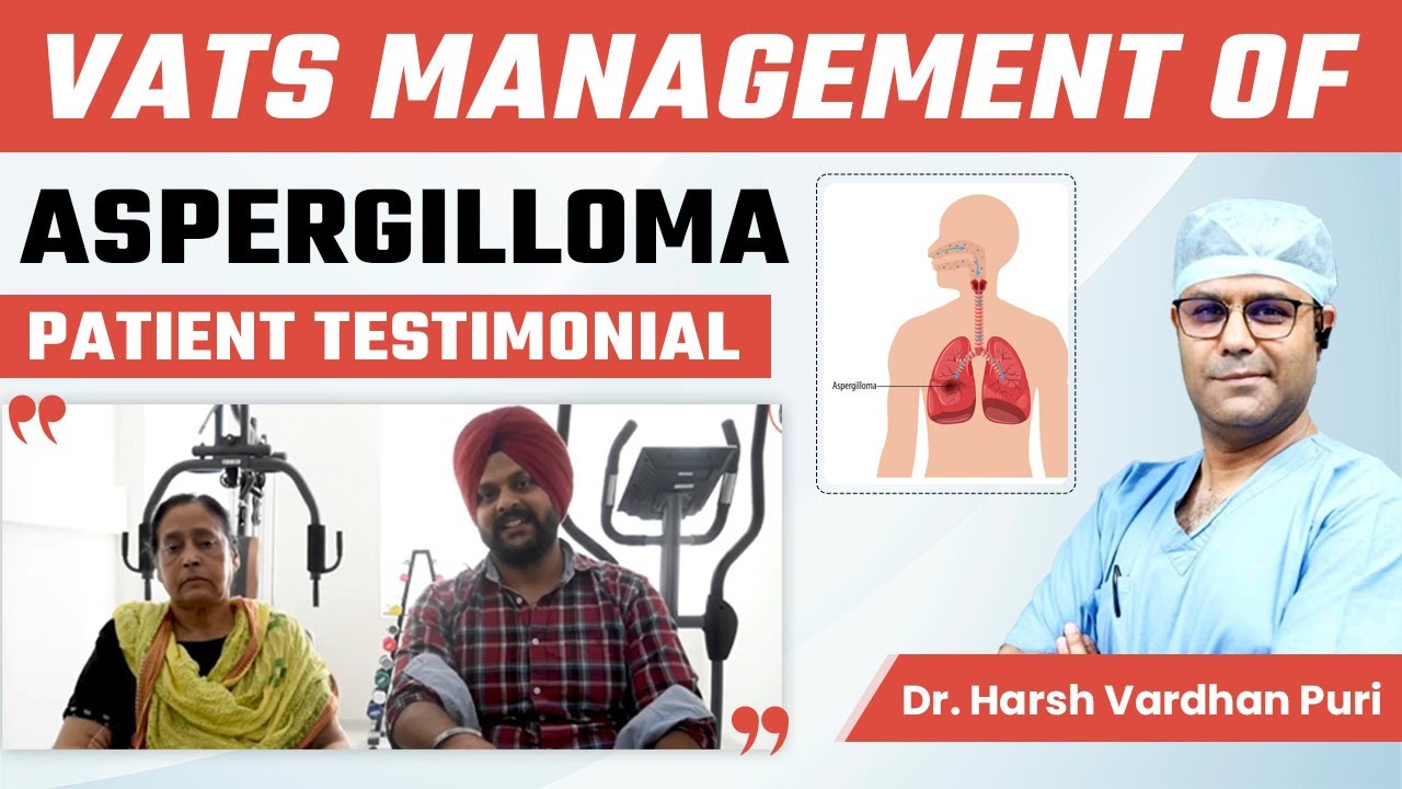 Patient Testimonal (VATS Management of Aspergilloma) | Dr. Harsh ...