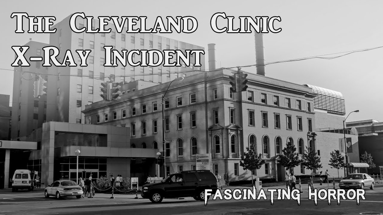 The Cleveland Clinic X-Ray Incident | A Short Documentary | Fascinating ...