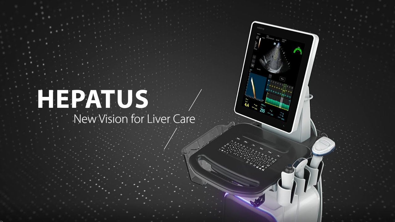 Mindray Hepatus Ultrasound Systems for Liver Diagnostics - YouTube