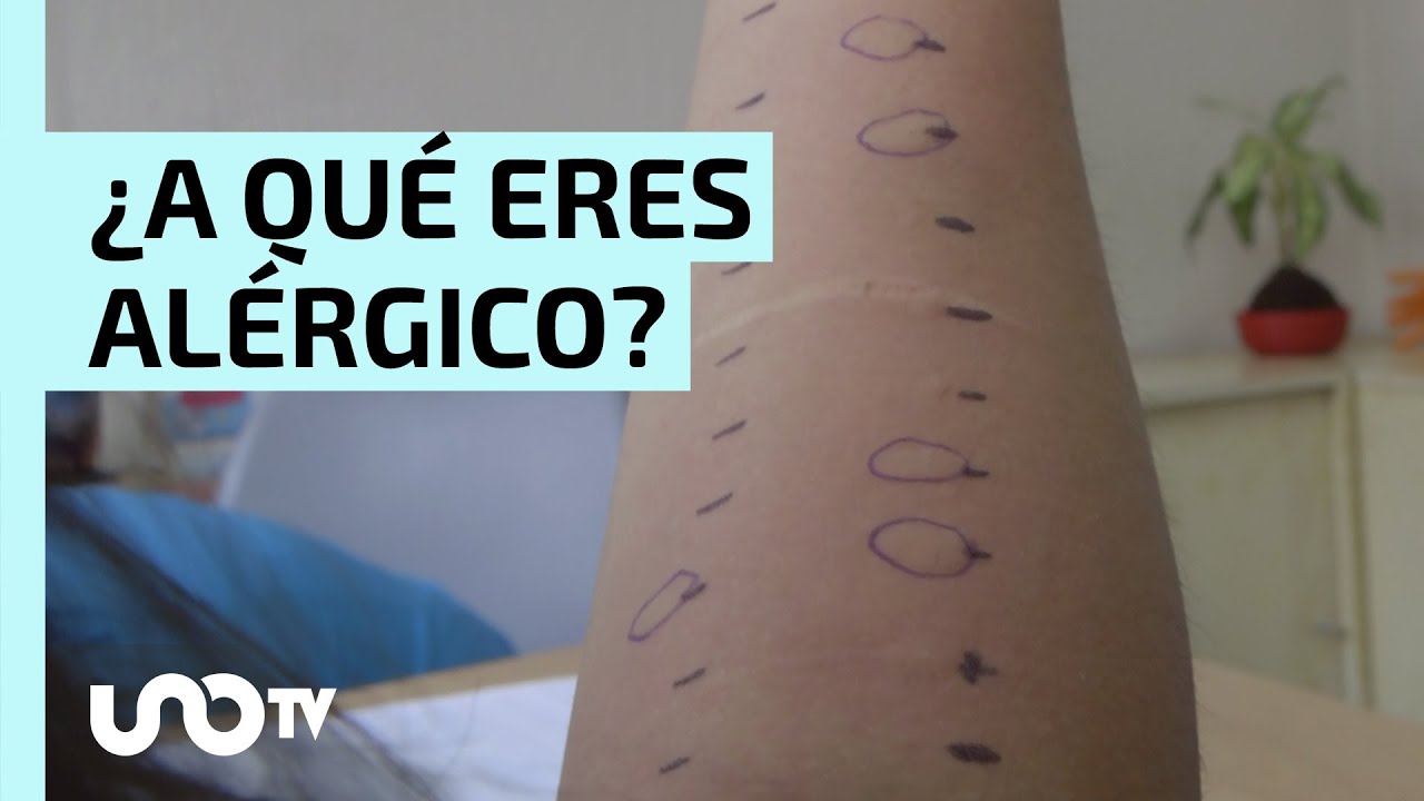 ¿Cómo son las pruebas para detectar alergias? - YouTube