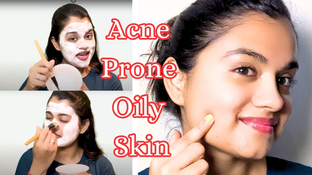 HOMEMADE FACE MASK TO REMOVE ACNE AND ACNE SCARS | OILY ACNE PRONE SKIN ...