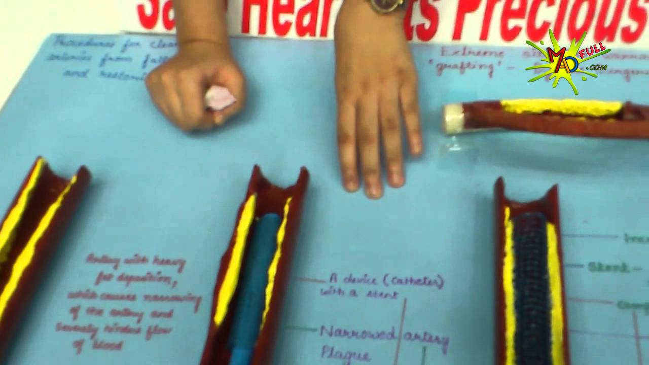 Human Arteries - Static Model Displayed by Student - YouTube