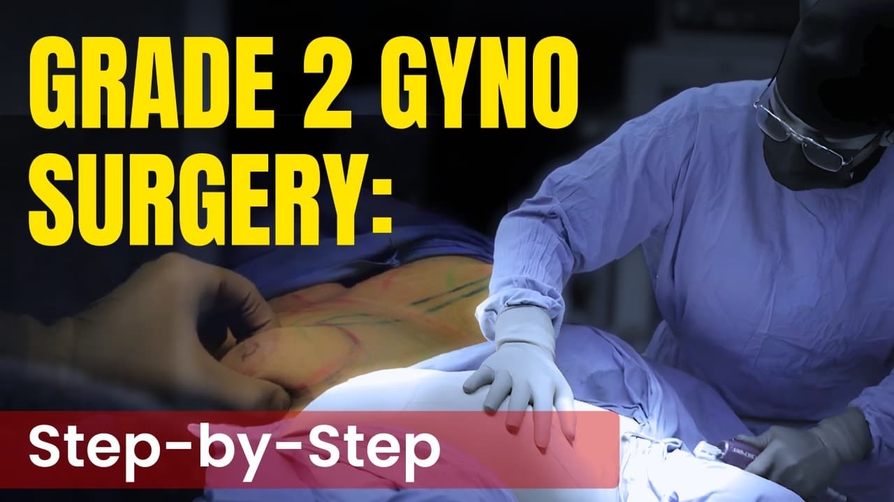 Weight Loss किया… फिर भी Chest Puffy? Reason Explained | Gyno Surgery ...