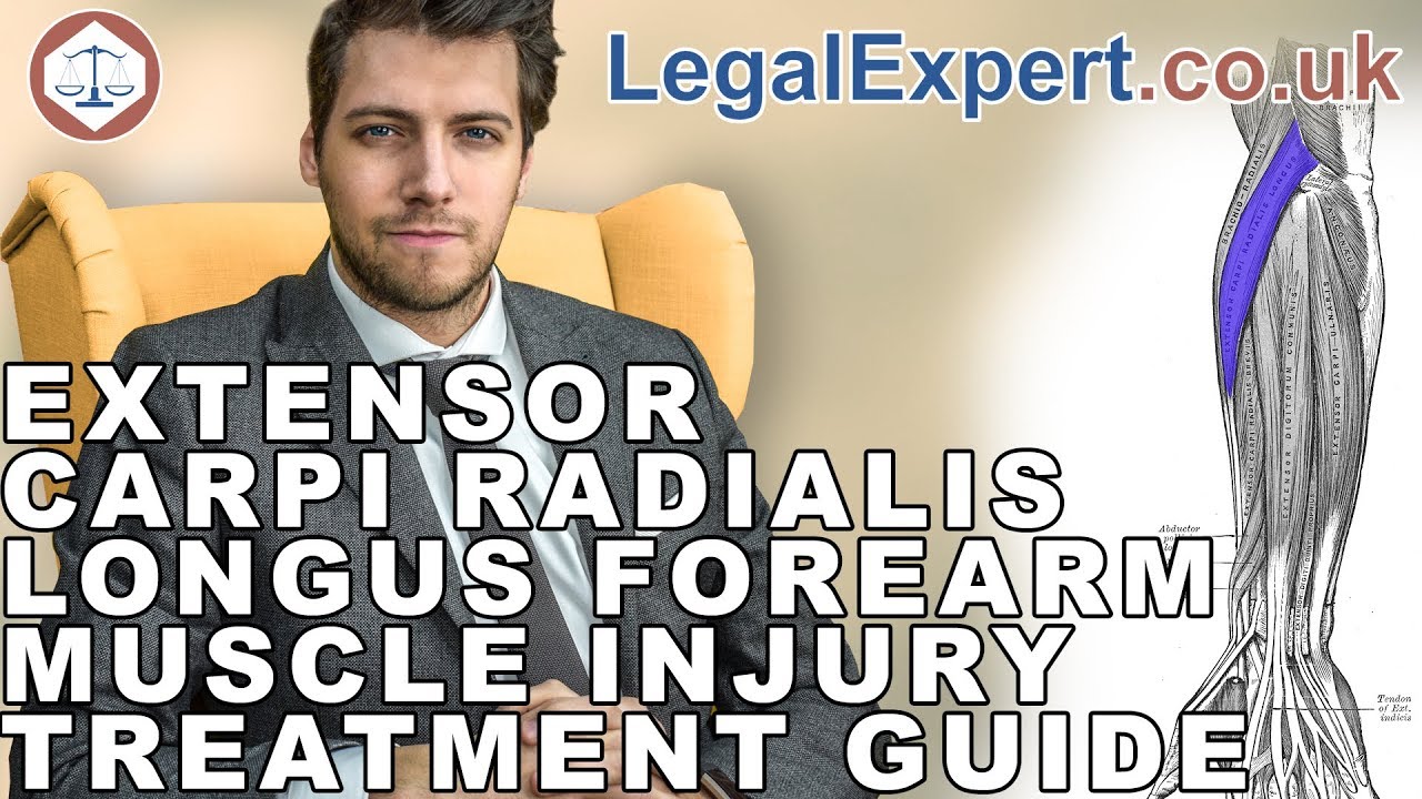 Extensor Carpi Radialis Longus Forearm Muscle Injury Treatment Guide ...