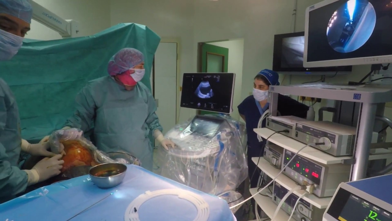 laser pour transfuseur transfusé - YouTube