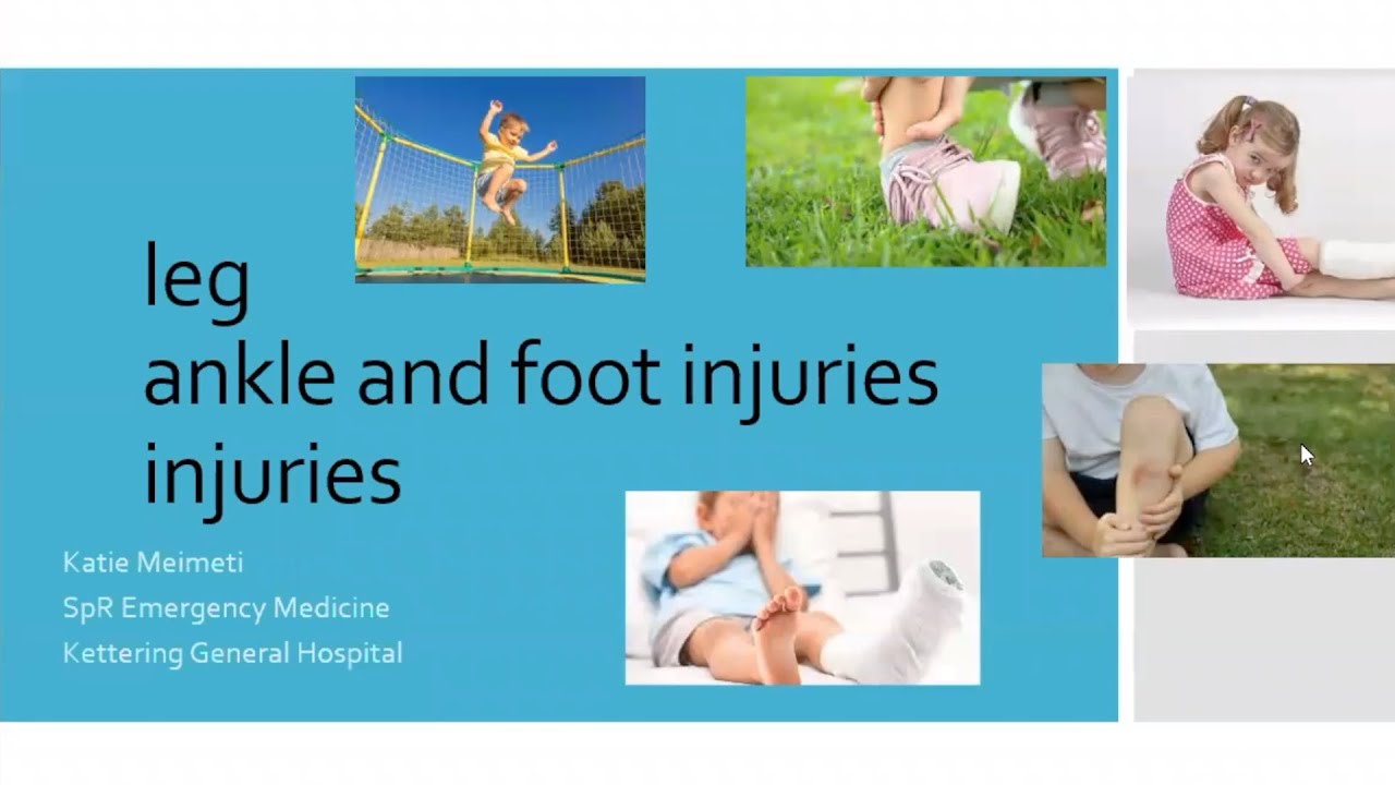 Paediatric Leg, Ankle and Foot Injuries - YouTube