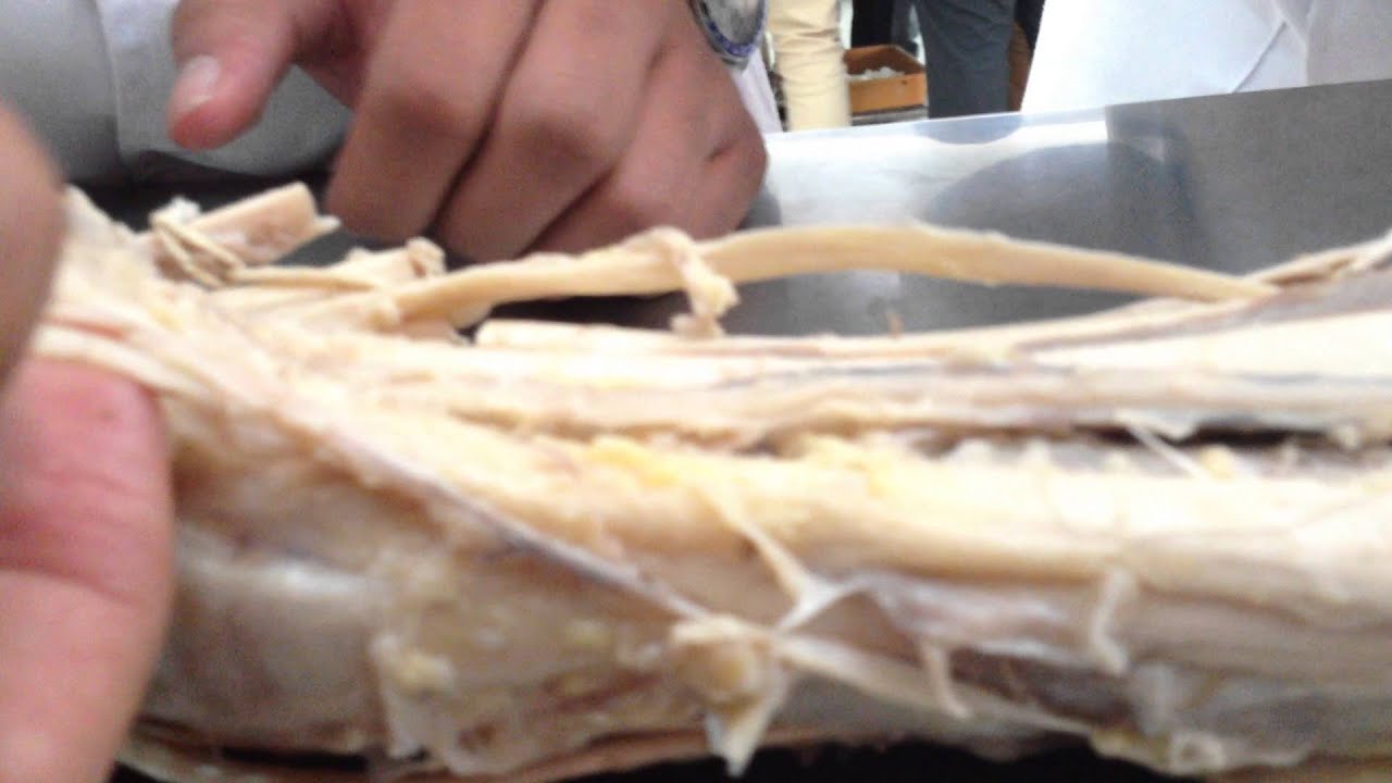 Anatomy dissection of arm - YouTube