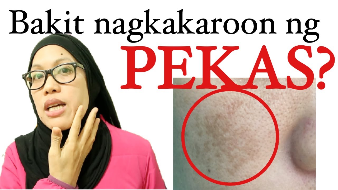 Ano ang PEKAS || 4 na dahilan ng pagkakaroon ng PEKAS - YouTube