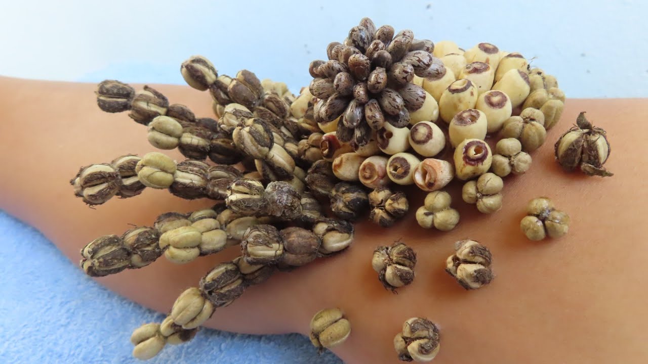 Amazing Ticks How To Remove Big Ticks Style On Knee Lady Designed From Lotus Seeds YouTube amazing-ticks-how-to-remove-big-ticks-style-on-knee-lady-designed-from-lotus-seeds-youtube