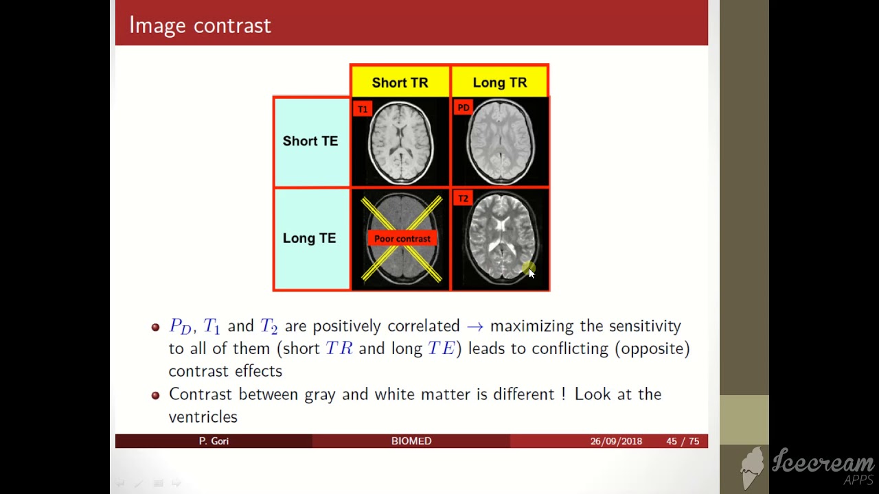 MRI Physics Part 15 T1 ,T2 and PD اساسيات فيزياء الرنين المغناظيسي ...