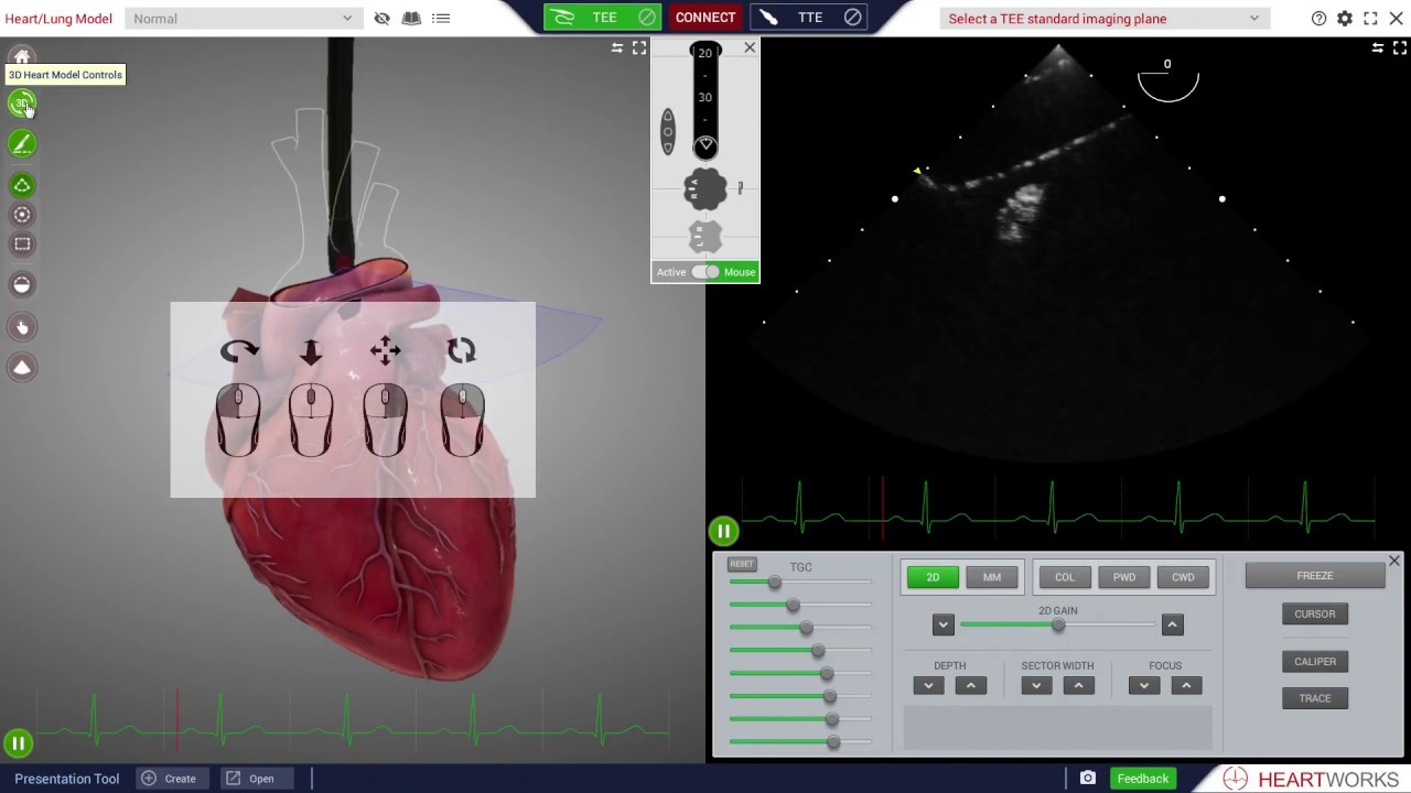 Interface Overview - HeartWorks Issue 10 - YouTube