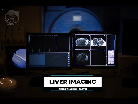 LIVER IMAGING – OPTIMIZING DWI (part 1)