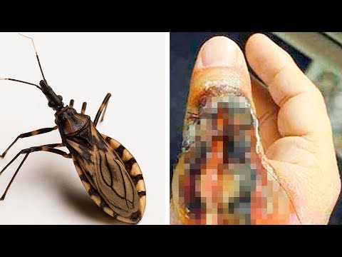 Gördüğünüzde Kaçmanız Gereken En Tehlikeli 7 Hayvan