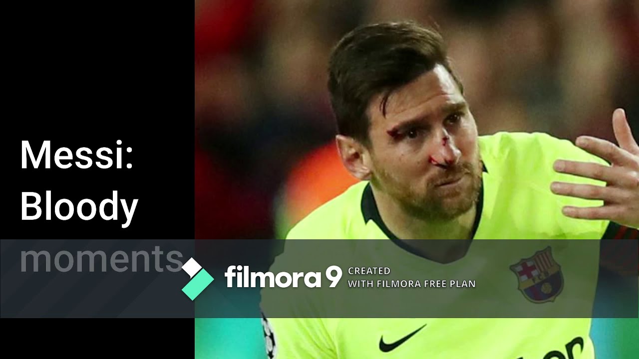 Best Football Ever - Bloody moments of footballers - YouTube