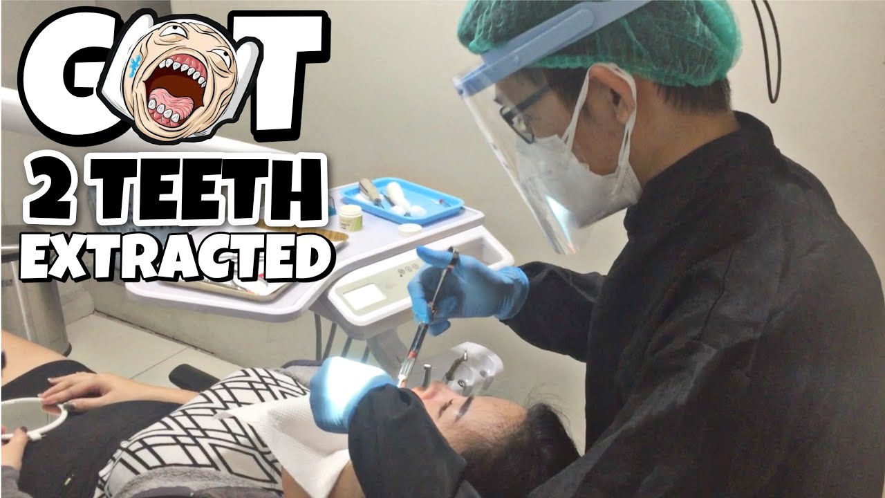 Teeth Extraction for Braces Adjustment - YouTube