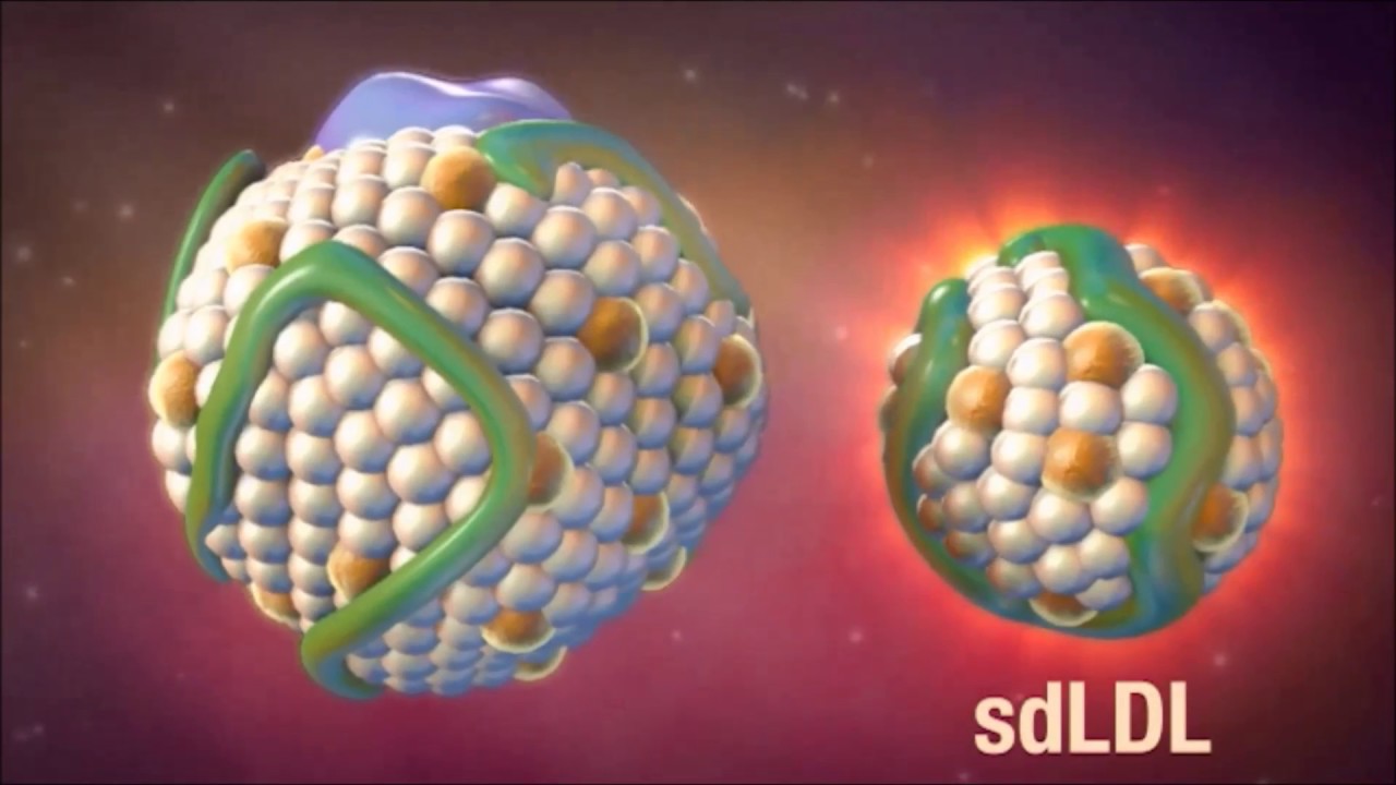預防心肌梗塞 - 最新的血液指標 ─ sdLDL 超壞低密度膽固醇(中文字幕) - YouTube