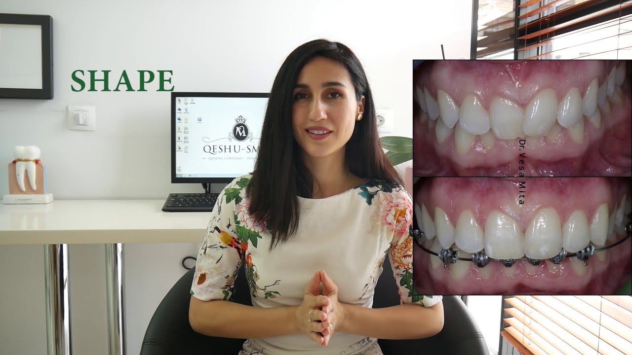 How your dentist can give you an aesthetically pleasing smile - YouTube