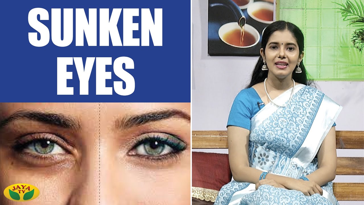 Sunken Eyes Symptom