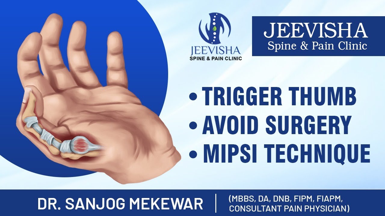 Trigger thumb | Avoid surgery | MIPSI technique - YouTube