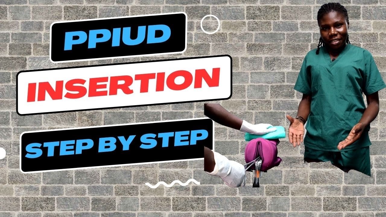 PPIUD INSERTION- Procedure - YouTube