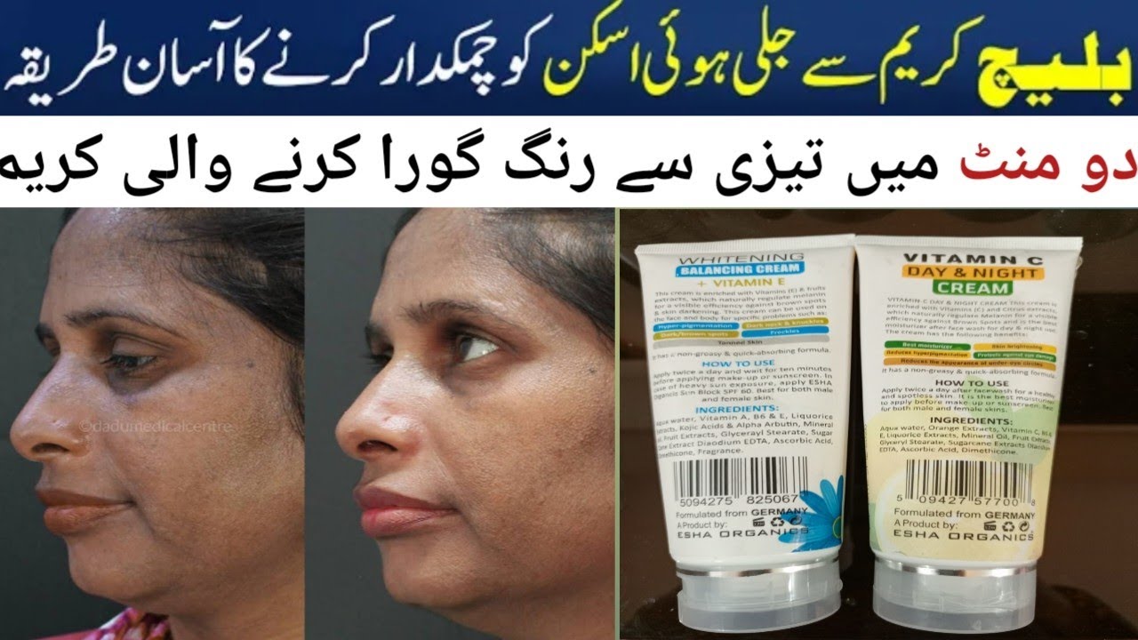 Best whitening cream, for glowing skin #glowingskin #fical by Esha ...