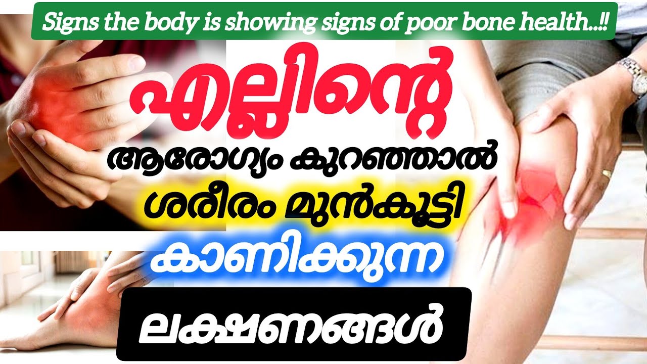 Signs the body is showing signs of poor bone health/എല്ലിന്റെ ആരോഗ്യം ...