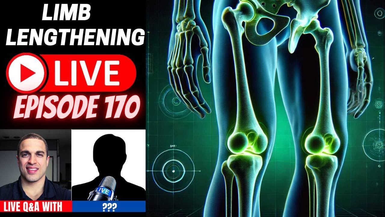 Limb Lengthening LIVE Ep. 170 – WATCH Aiden & Aaron Complete Their ...
