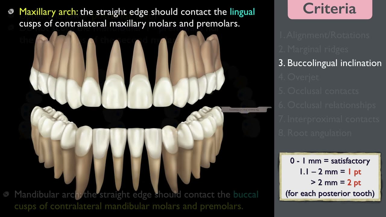 CC365. Cast-Radiograph Evaluation (CRE) Part 1 - YouTube