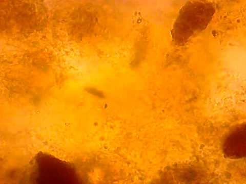 observation de bactéries méthanogènes au microscope - YouTube