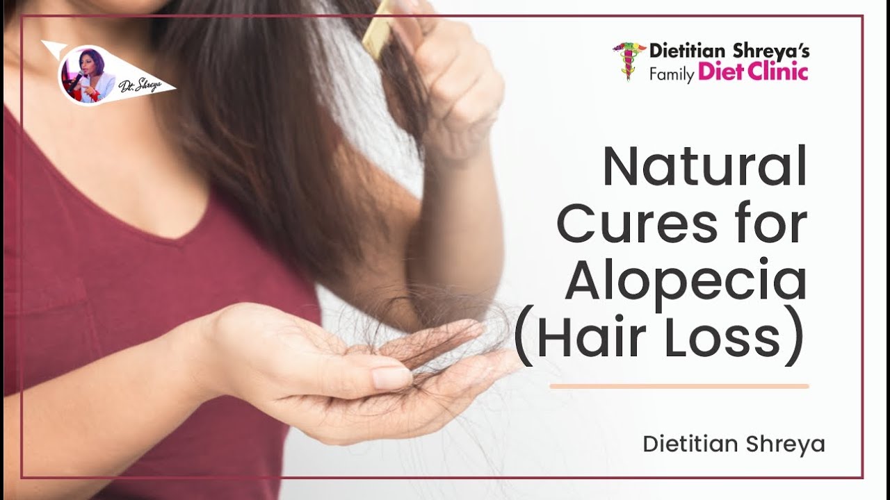 Natural Cures for Alopecia ( Hair Loss ) - YouTube