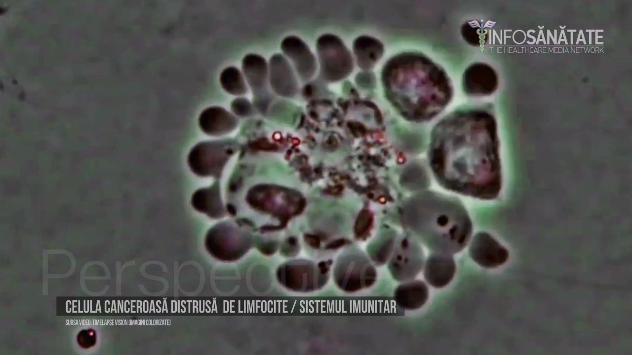 Perspective - Celula canceroasă distrusă de limfocite - YouTube