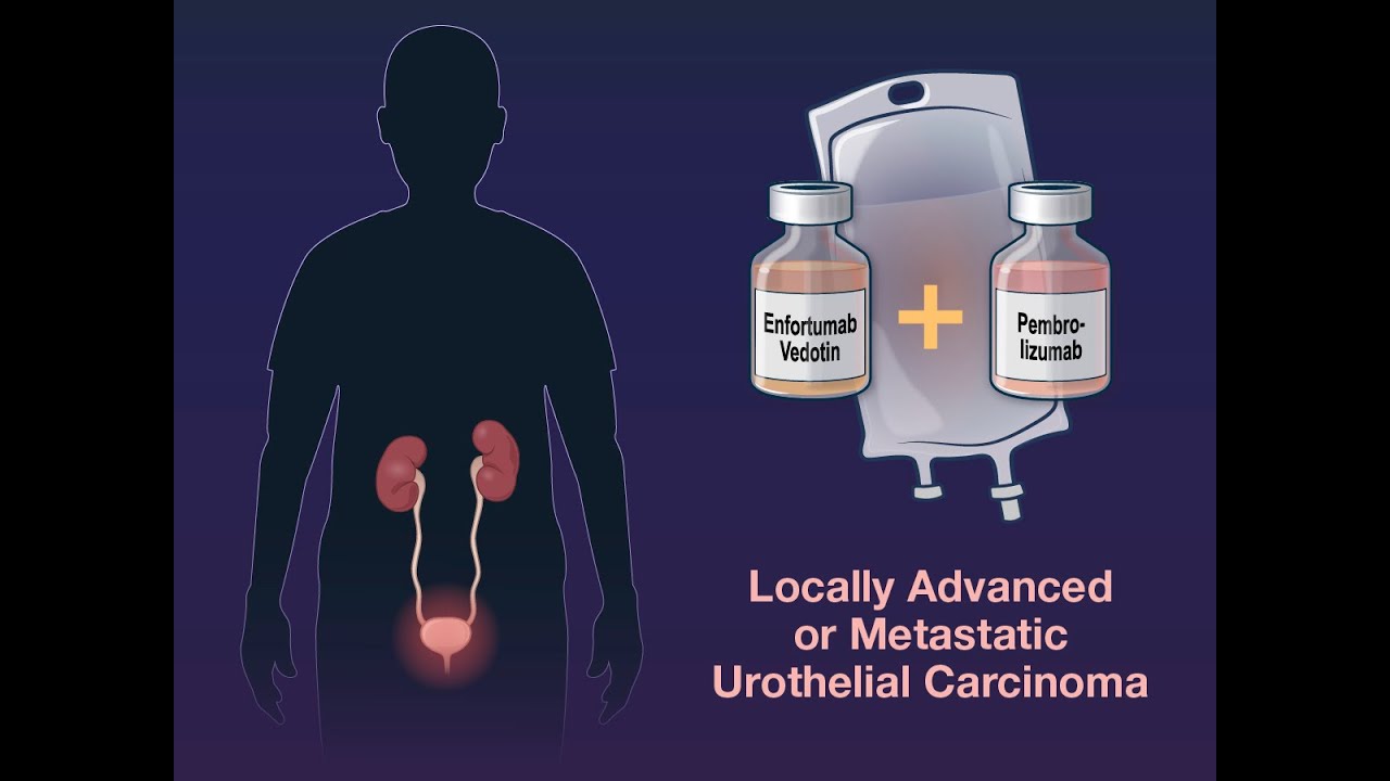 Enfortumab Vedotin–Pembrolizumab in Advanced Urothelial Cancer | NEJM ...