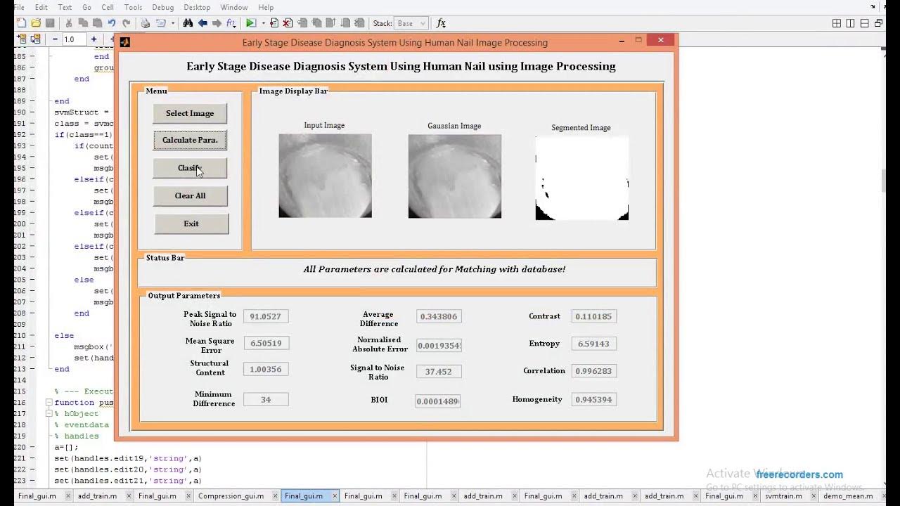 Finger Nail Disease Detection matlab code - YouTube