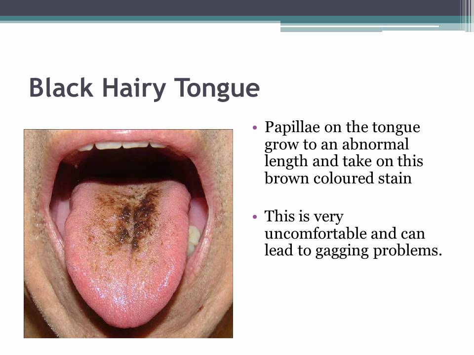 Smoking and Oral Health - YouTube