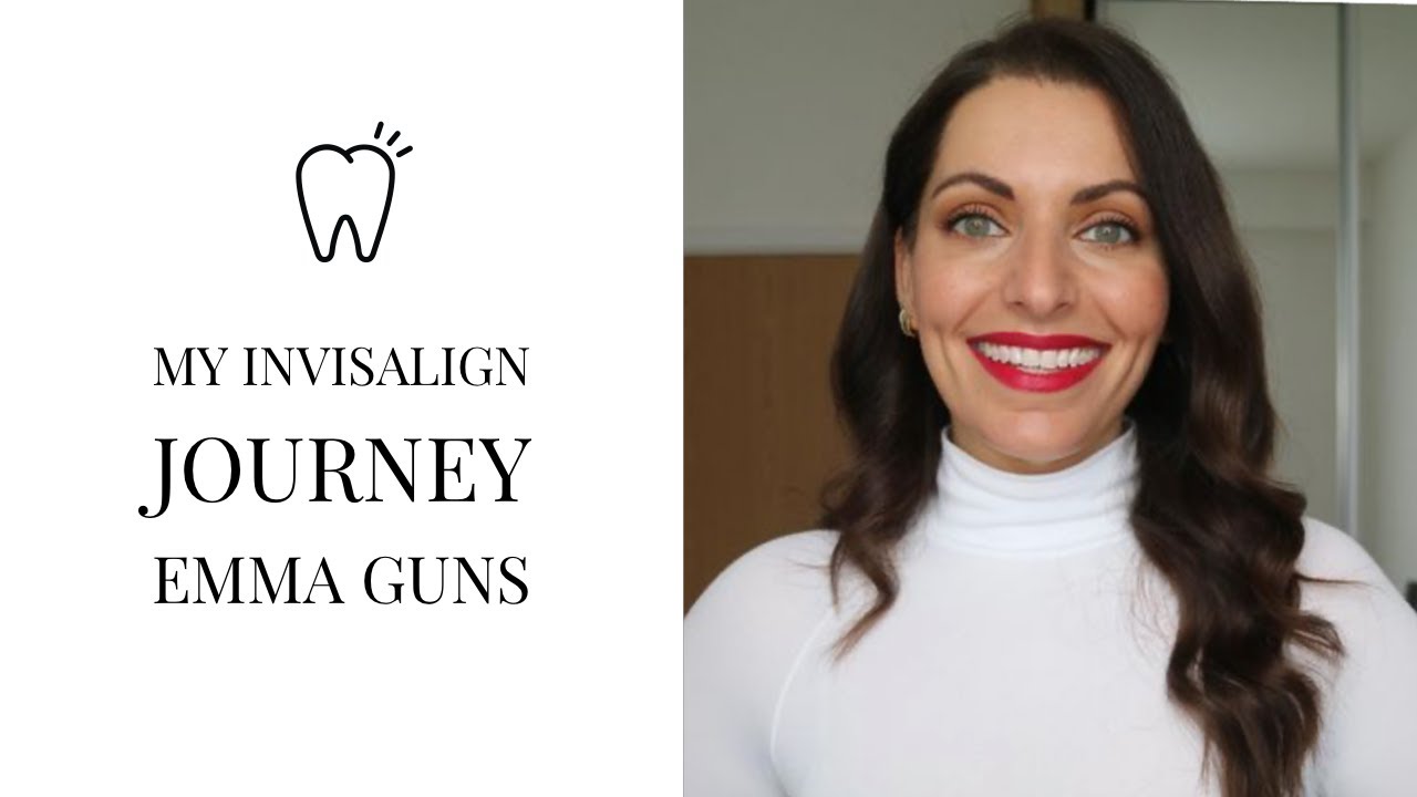 Everything you wanted to know about Invisalign by Emma Guns. Part 1 ...