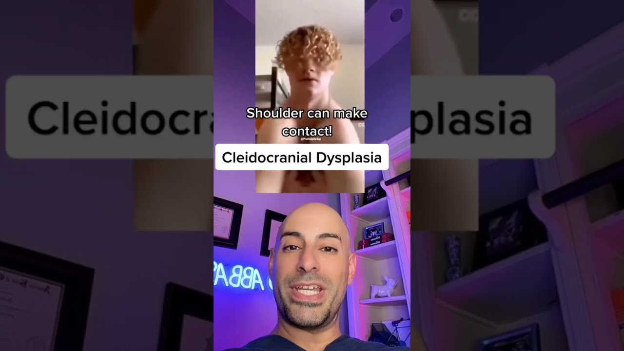 Missing Collarbone in Cleidocranial Dysplasia! #shorts - YouTube