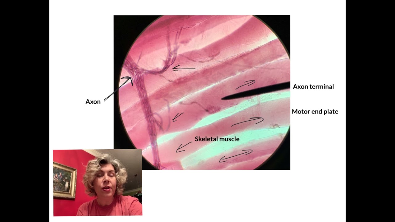 Labeled Neuromuscular Junction Slide