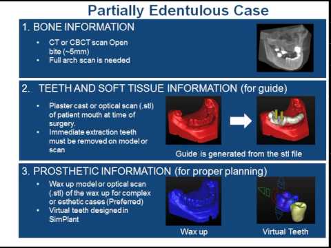 1A. SimPlant Protocols Explained - YouTube