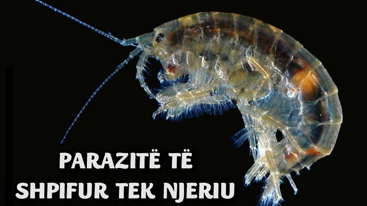 6 RASTE KUR PARAZITËT "PUSHTUAN" TRUPAT NJERËZOR - YouTube