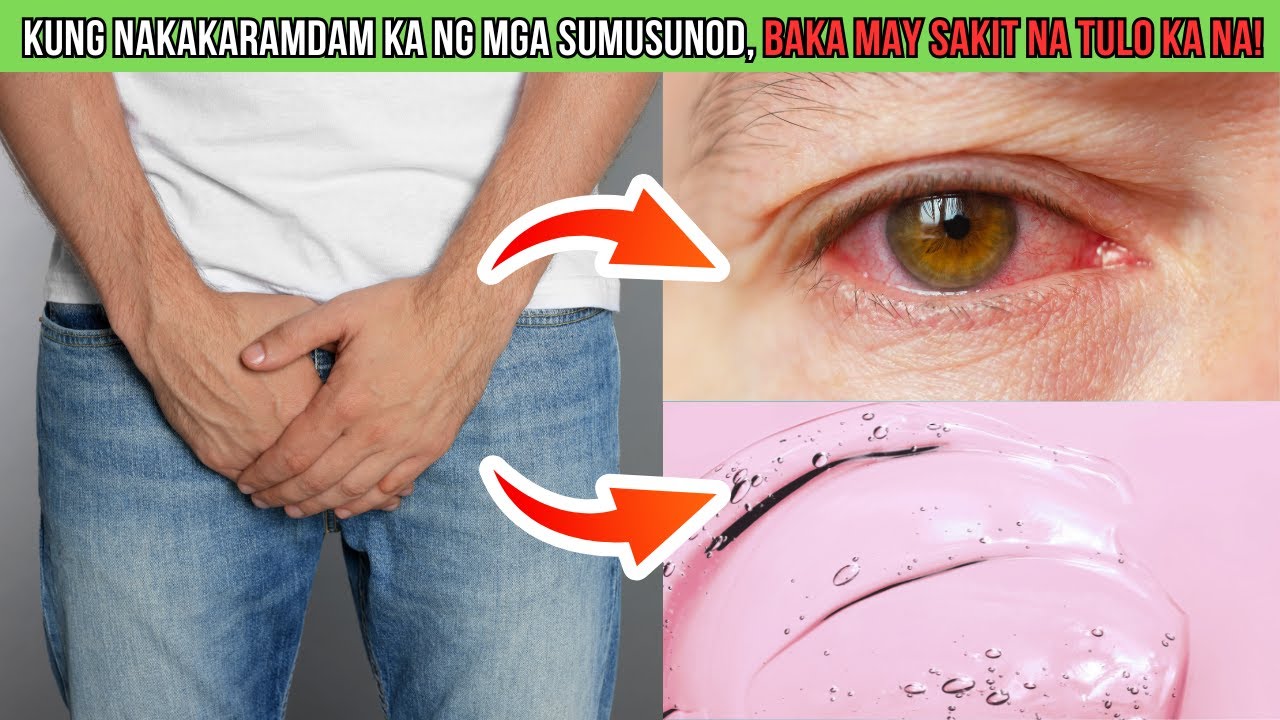 TOP 5 Senyales ng TULO o GONORRHEA sa isang LALAKI! - YouTube