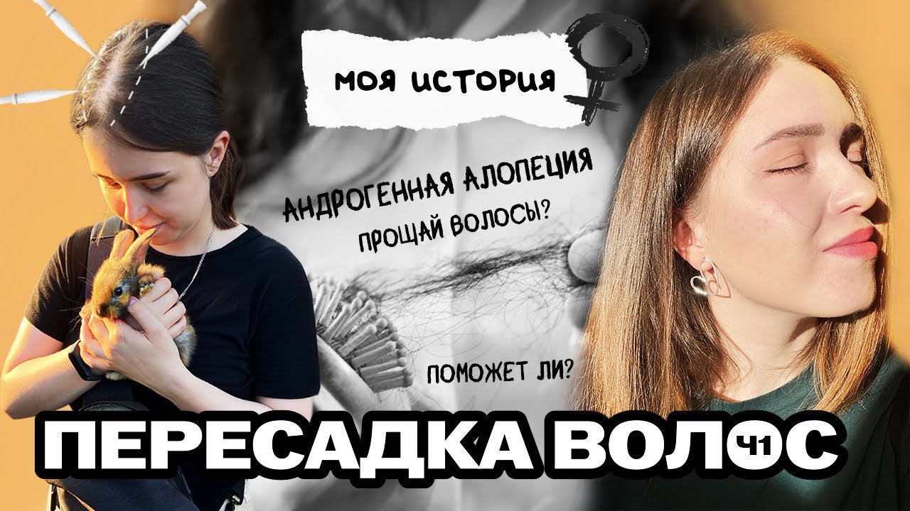 Женская пересадка волос Андрогенная алопеция Видео ДО пересадки