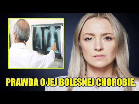 Barbara Kurdej-Szatan: prawda o jej bolesnej chorobie.
