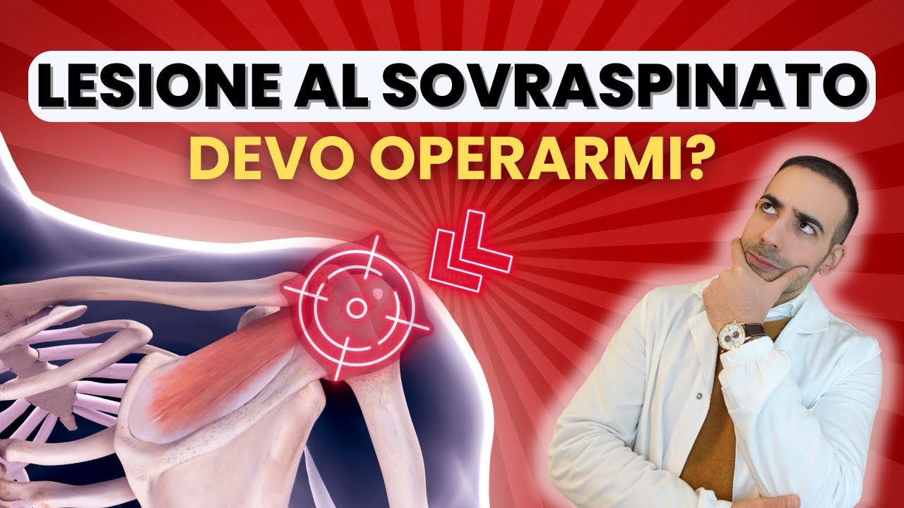 Lesione del SOVRASPINATO | Come Riconoscerla e quando Operare - YouTube