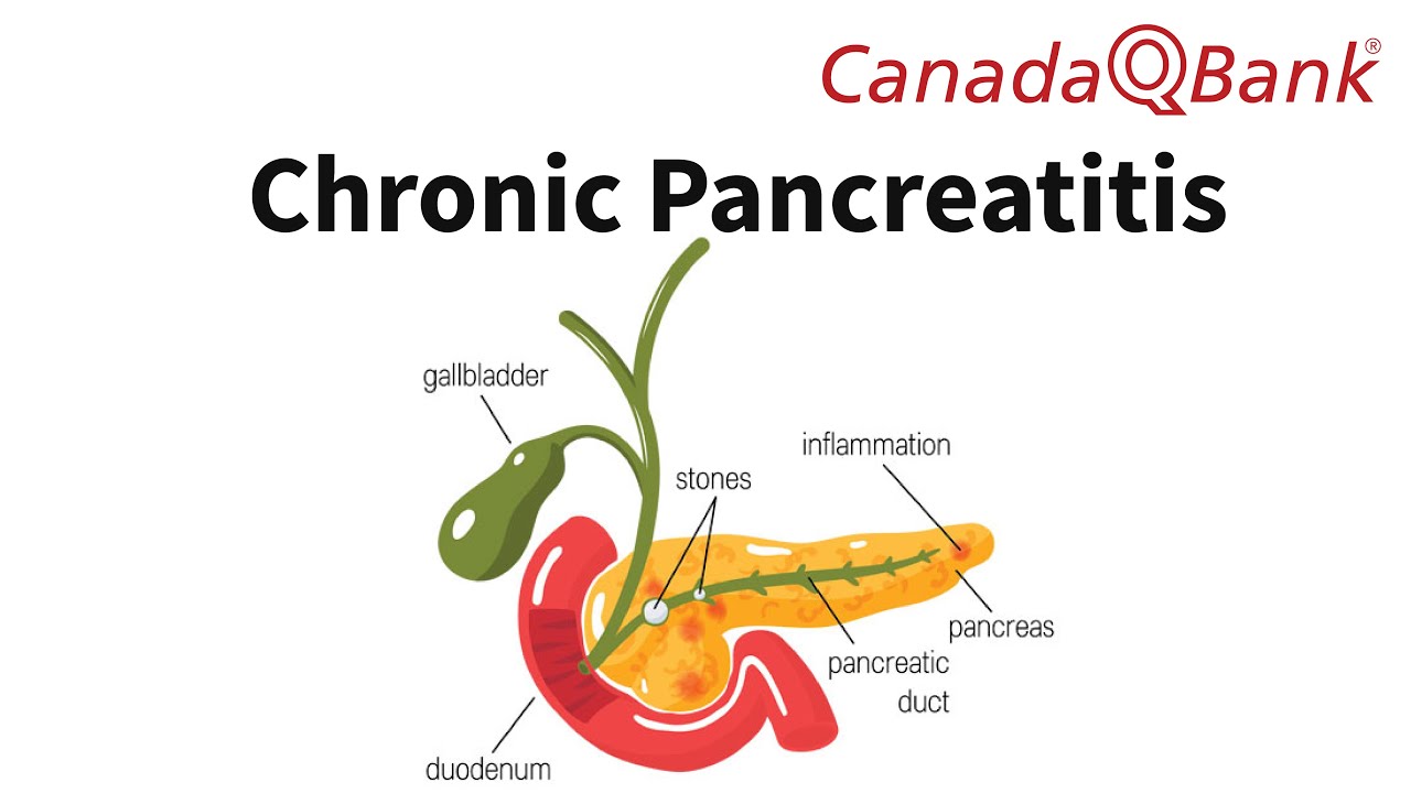 Chronic Pancreatitis Slide Show Understanding Chronic Pancreatitis
