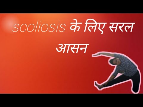Scoliosis Of Lumbar Spine Convexity Towards Left Side - YouTube
