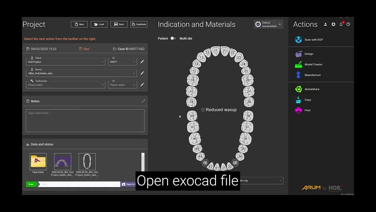 How to use Hoil Master Library_for Exocad - YouTube