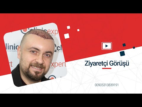 ✔️ Bizi Hastalarımızdan Dinlediniz mi? - ClinicExpert