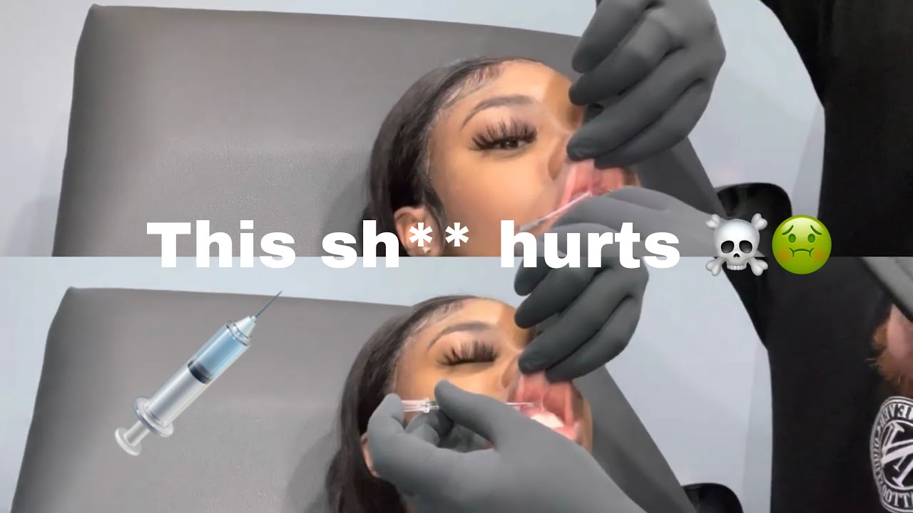 Mini Vlog- Getting the smiley piercing 💉💀 warning graphic content - YouTube